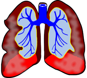 What Is Labored Breathing? 8 Clear Reasons Behind Dyspnea