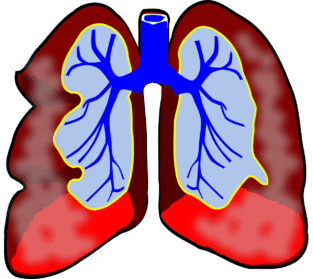 What Is Labored Breathing? 8 Clear Reasons Behind Dyspnea