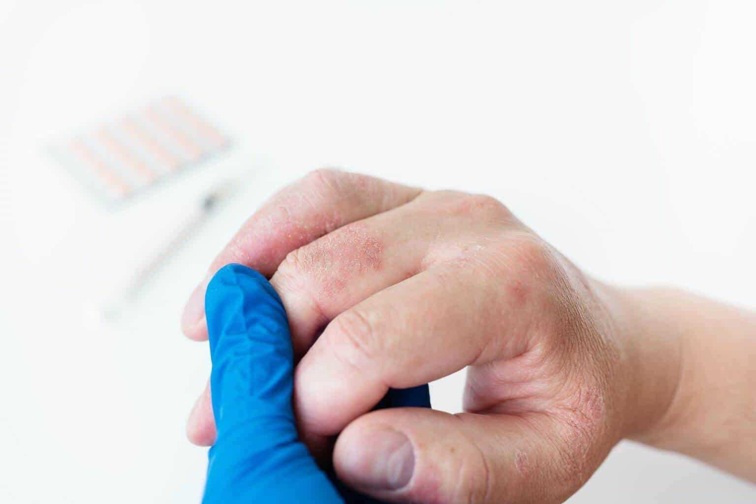 From Superstition To Science: Exploring The Real Reasons Behind Itchy ...