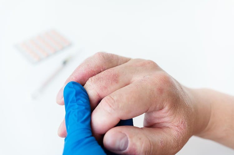 From Superstition To Science: Exploring The Real Reasons Behind Itchy ...