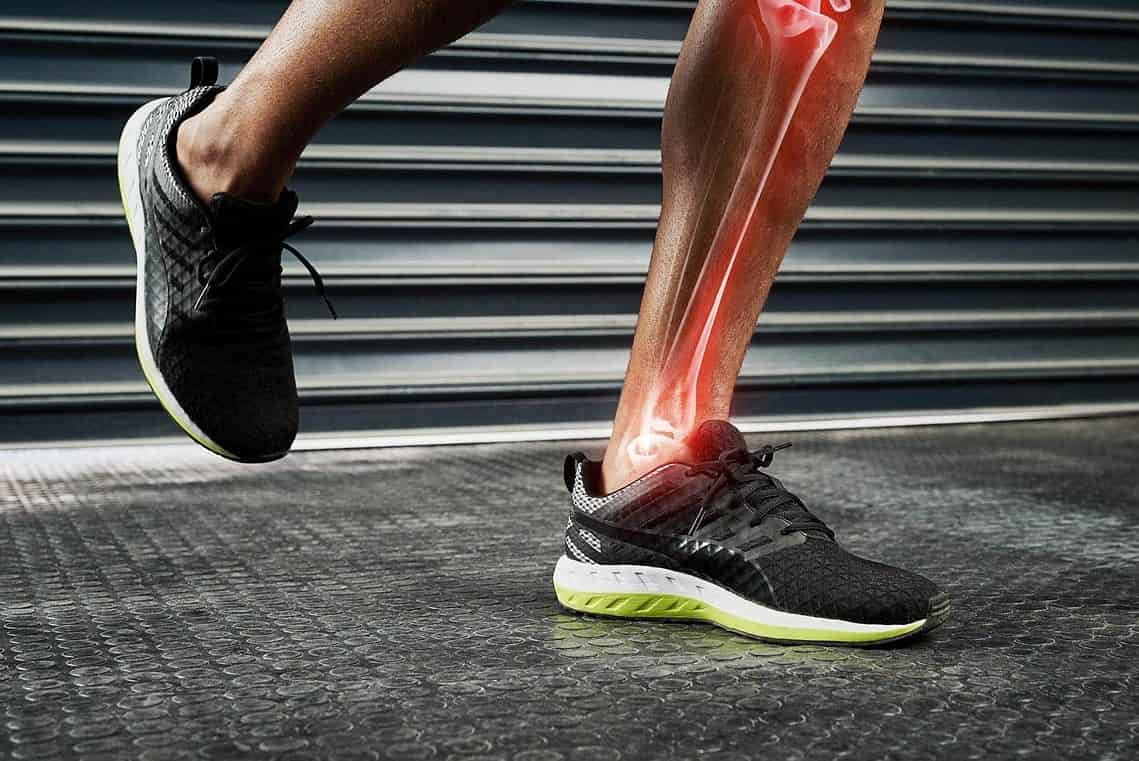 Inner Thigh Pain - 12 Awful Causes And 6 Best Treatments